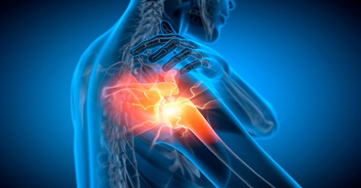 Shoulder Pain? Dr. Ram Yaron on the Innovations, Treatments, and ...